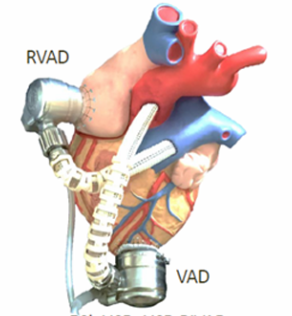 CardioBionic MedTech India