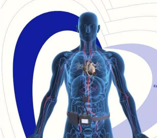 CardioBionic MedTech India